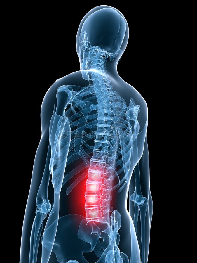 Rugpijn stock illustratie. Illustration of anatomisch - 5564667