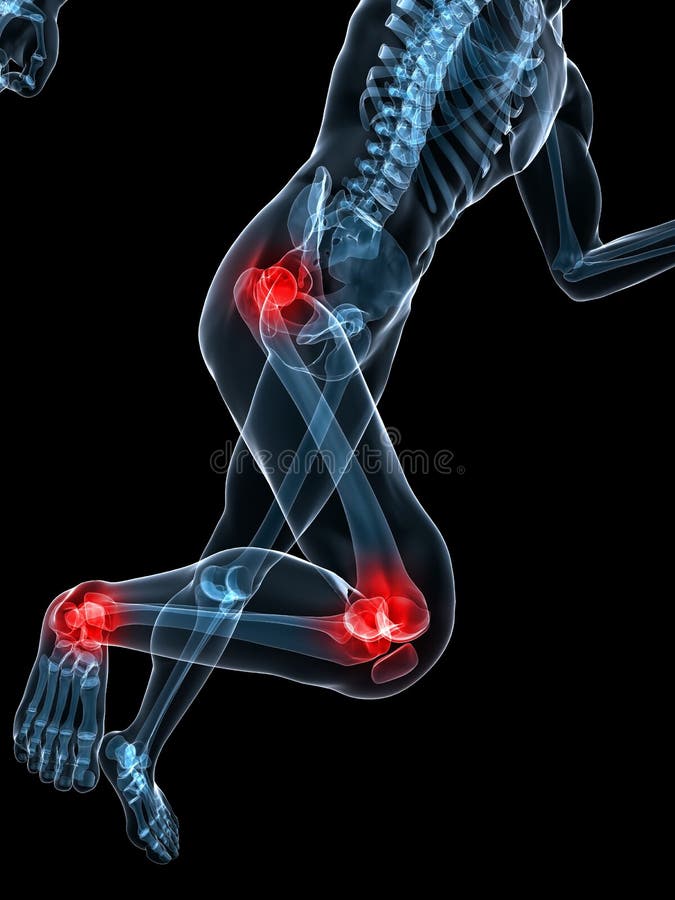 Running Skeleton - Painful Knee and Hip Stock Illustration ...