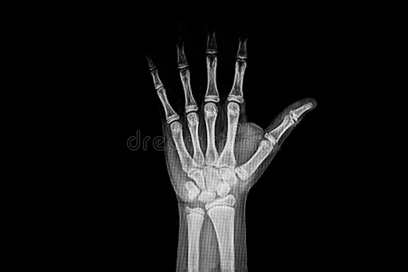 Left Hand Rx Stock Photos - Free & Royalty-Free Stock Photos from ...