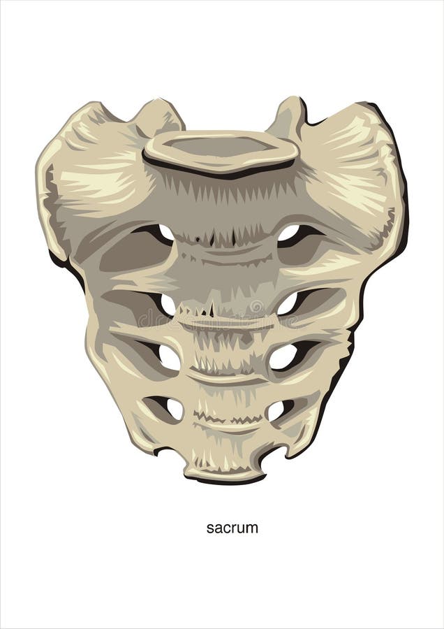 Spinal Osteoporosis. Vertebral Lesion Anatomical Poster. Disease of ...