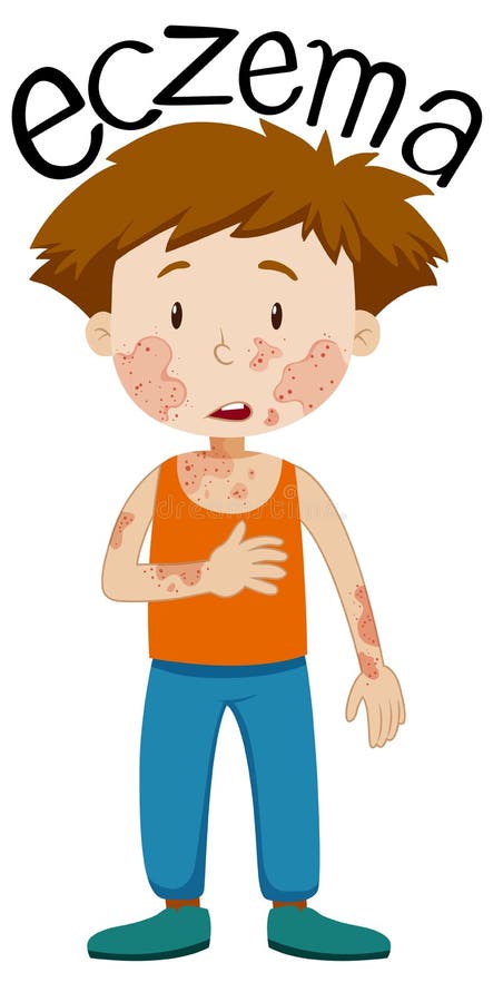 Eczema Stock Illustrations – 1,757 Eczema Stock Illustrations, Vectors ...