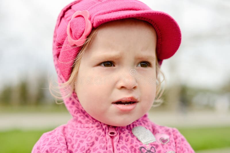 Sad Girl with Injury on Lip Stock Image - Image of assistance, person ...