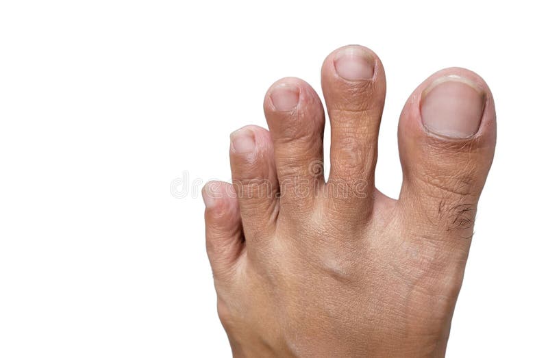 Close-up of the Toe on a White Background Stock Photo - Image of human ...