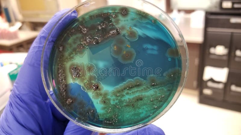 Salmonella Black Colonies and Pseudomonas on Chromogenic Agar Stock ...