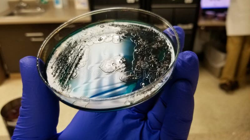 Salmonella Black Colonies and Pseudomonas on Chromogenic Agar Stock ...
