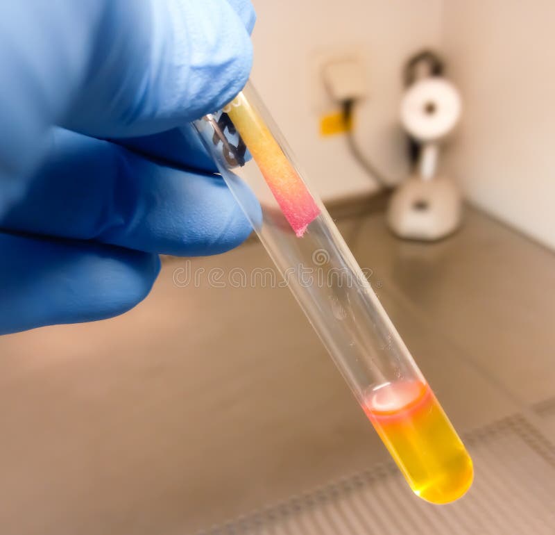 Salmonella Detection Method by Using Triple Sugar Iron (TSI) Agar in ...