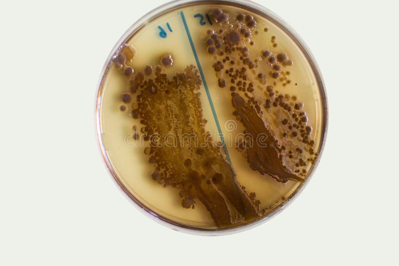 Salmonella on Bismuth Sulphite Agar Stock Photo - Image of ...