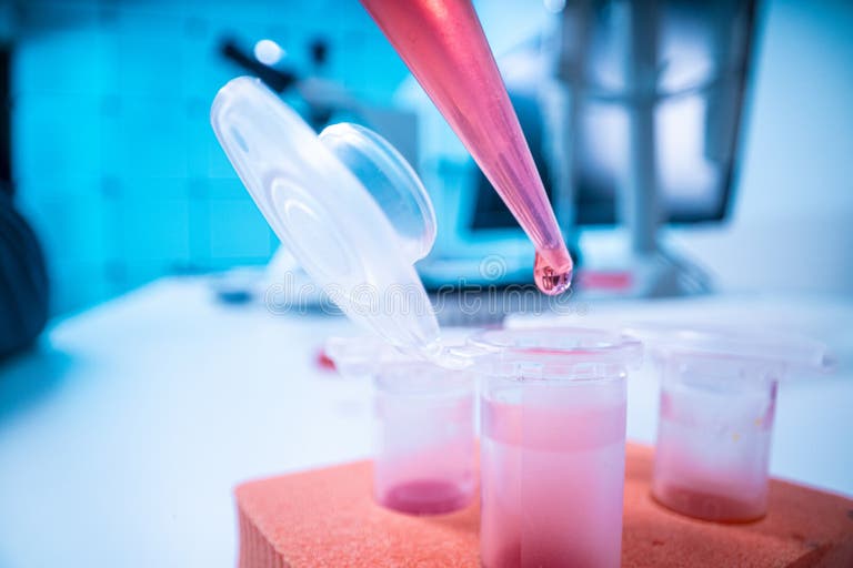 Sample of Biological Sample for DNA Analysis Stock Photo - Image of ...