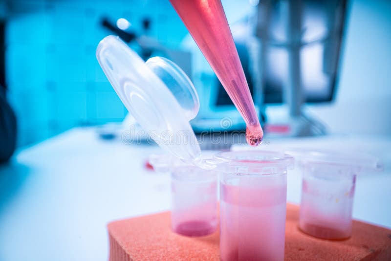 Sample of Biological Sample for DNA Analysis Stock Photo - Image of ...