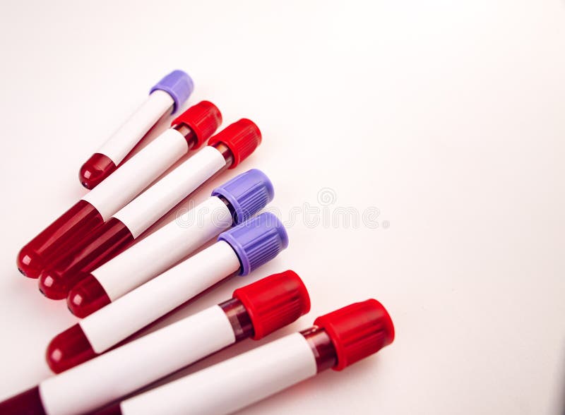 Sample Blood Collection Tubes Stock Photo - Image of virus, experiment ...