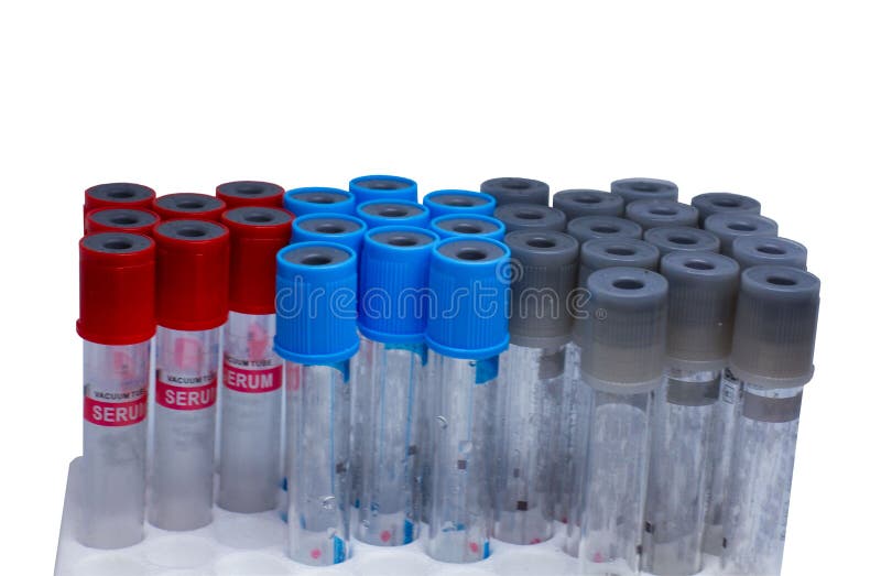 Sample blood exam stock image. Image of blue, disease - 173922539