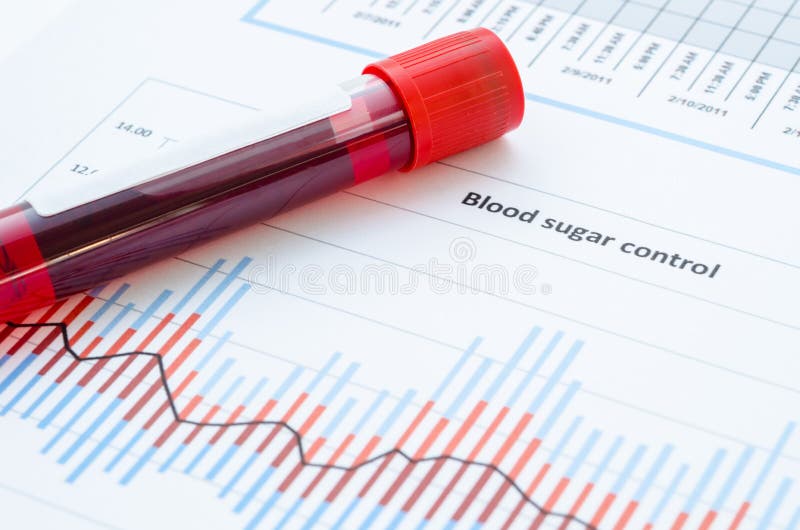Sample Blood for Screening Diabetic Test. Stock Photo - Image of care ...