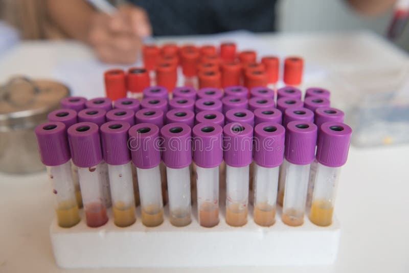 Sample Blood Tube from Patient in Laboratory . Stock Image - Image of ...