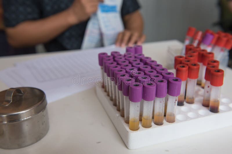 Sample Blood Tube from Patient in Laboratory . Stock Image - Image of ...