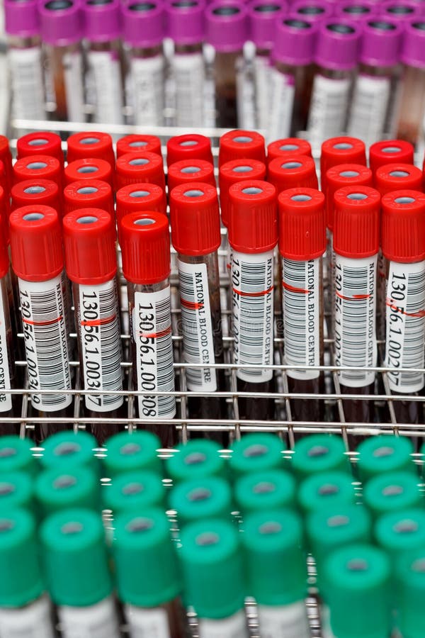 Sample Blood Tubes In Lab ratory Stock Image - Image of laboratory ...
