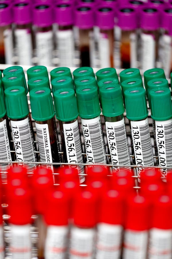 Sample Blood Tubes in Lab ratory Stock Photo - Image of science ...