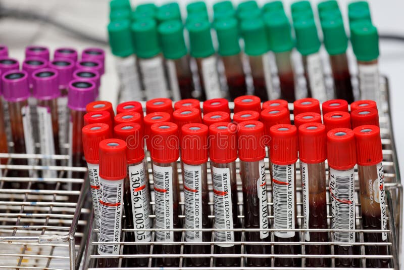 Sample Blood Tubes in Labratory Stock Image - Image of sample ...