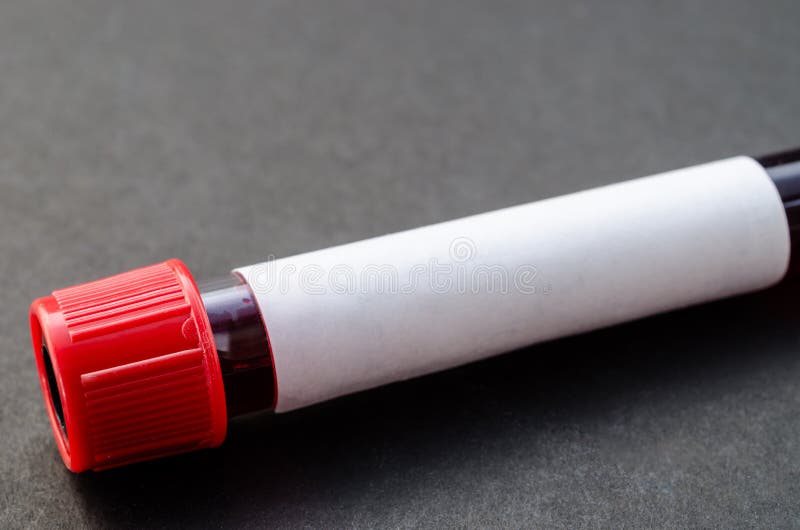 Sample Blood in Vacuum Tubes Stock Image - Image of bloodwork, health ...