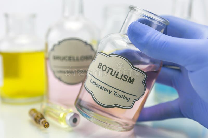 Sample of Cholera in Laboratory Stock Photo - Image of analysis ...