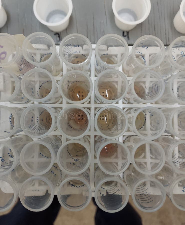 Labworksamples Stock Photos - Free & Royalty-Free Stock Photos from ...