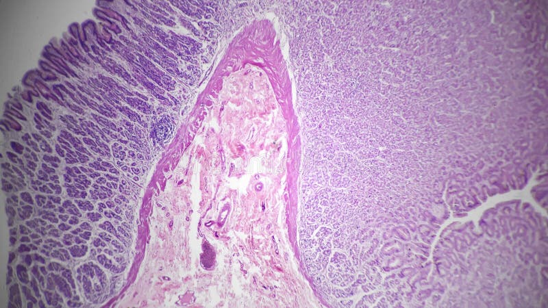 Human Stomach Anatomy Digestion, Esophagus Abdomen Gastric with Acid ...