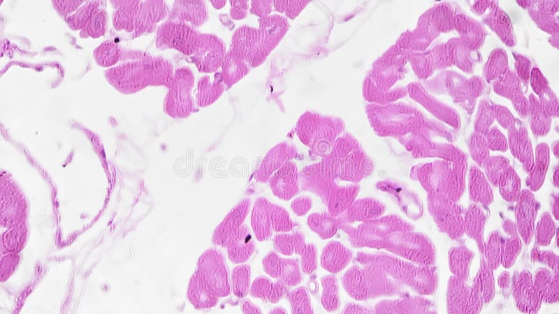 Sample of Large Vein in Section Magnified Under Microscope in 200 Times ...