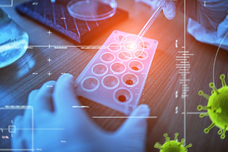 Sample plates with blood stock image. Image of blood - 179929465