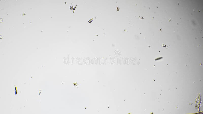 Sample of Pond Water with Microorganisms Living There Magnified Under ...
