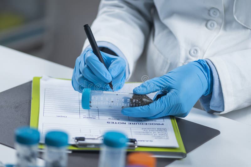 Sample Preparation for Pesticide Testing in Laboratory Stock Photo ...