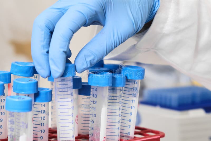 Sample Preparation Process by Analytical Chemist. Close Up Womans Hand ...
