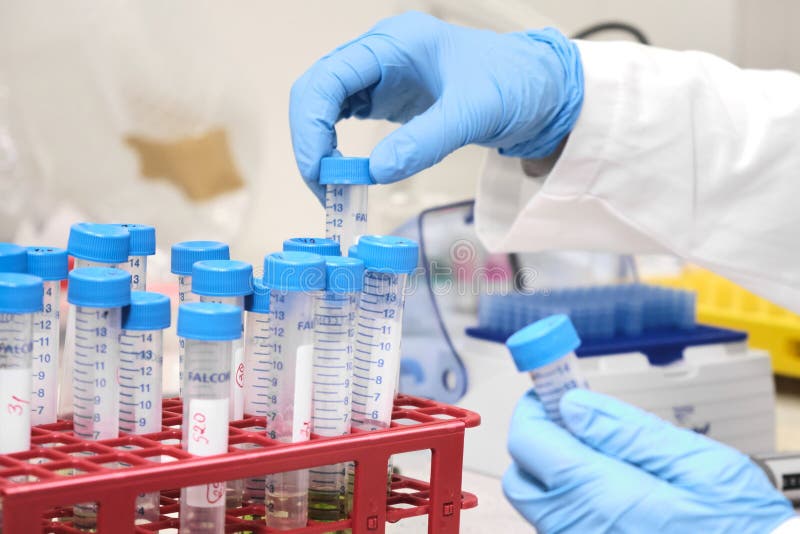 Sample Preparation Process by Analytical Chemist. Close Up Womans Hand ...