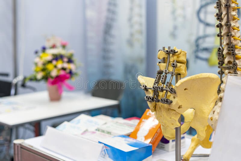 Sample Structure Show Hip Bone and Spine Bone with Metal Fixation Set ...