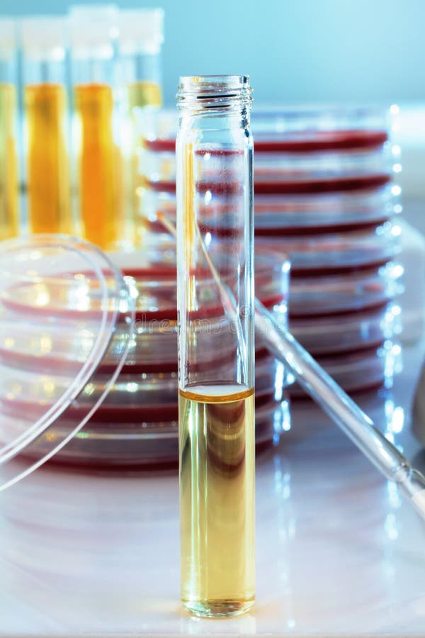 Sample in a Test Tube in the Research Laboratory Workbench Stock Image ...