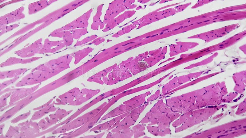 Human Tongue in Longitudinal Section Showing Filiform Papillae Under ...