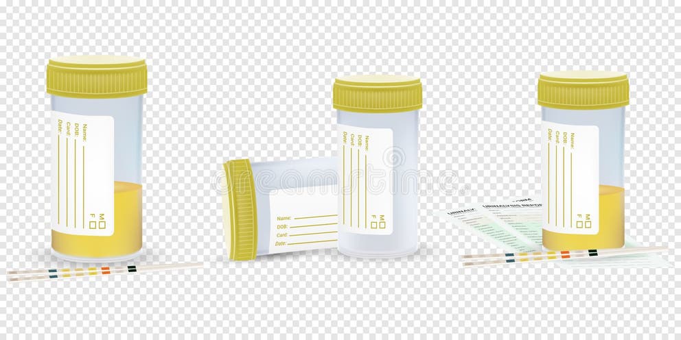 A Sample of Urine. Laboratory Analysis of Urine Using Test Strips ...