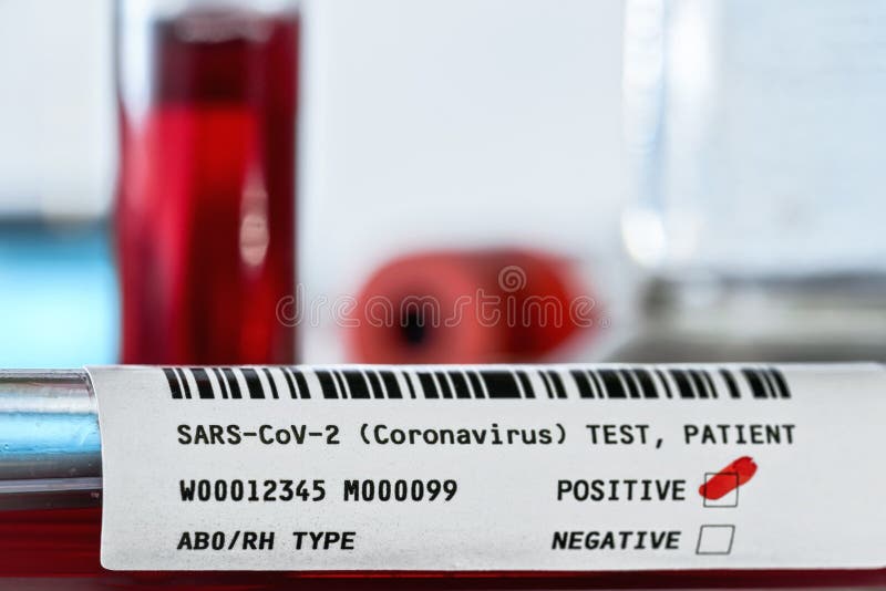 Sample Vial with Blood, Label Own Design, Dummy Barcode & Data ...