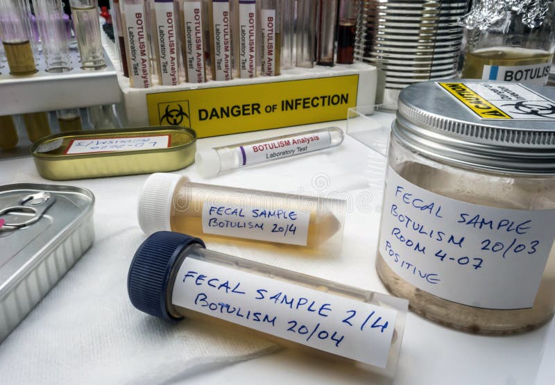 Samples Contaminated by Clostridium Botulinum Toxin that Causes ...