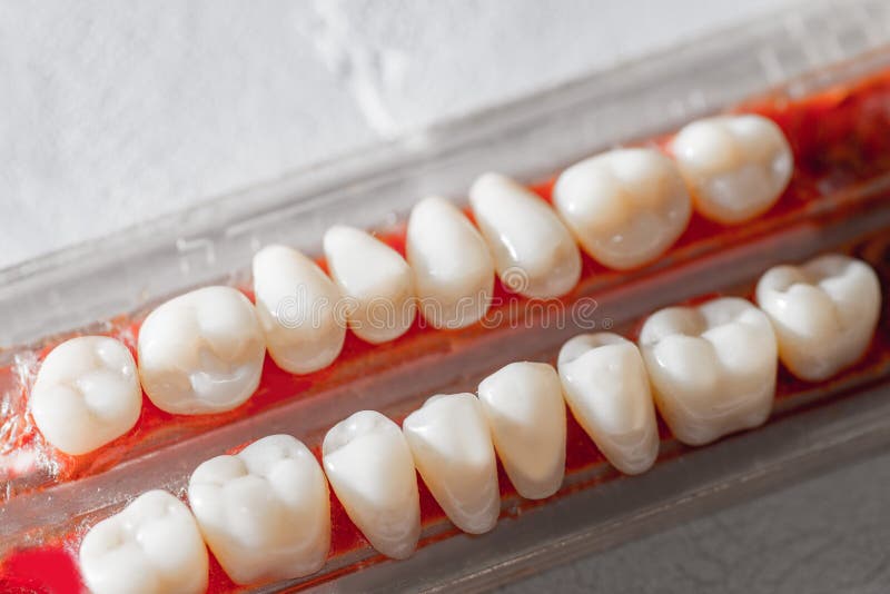 Samples of human teeth stock photo. Image of chewing - 139013220