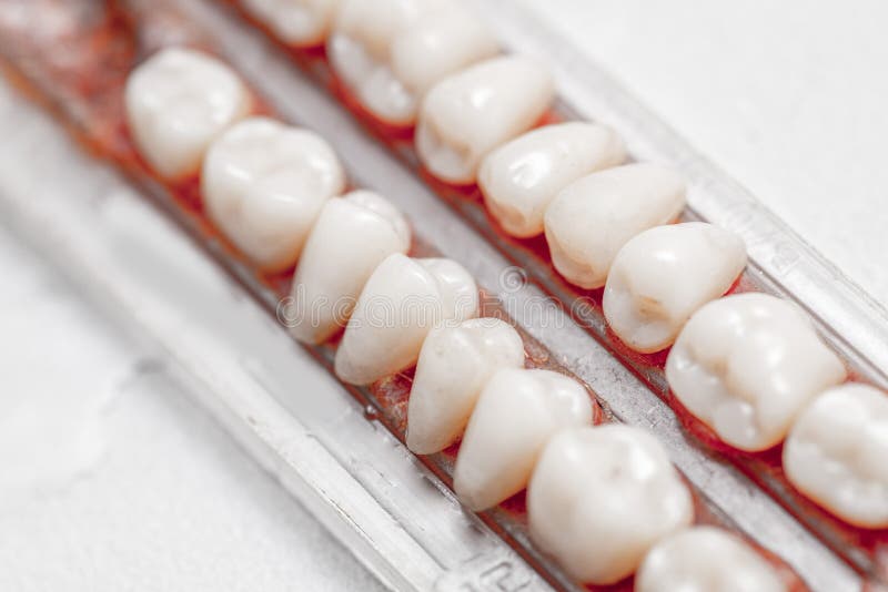 Samples of human teeth stock image. Image of implant - 140229889