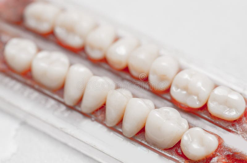 Samples of human teeth stock photo. Image of filling - 140229932