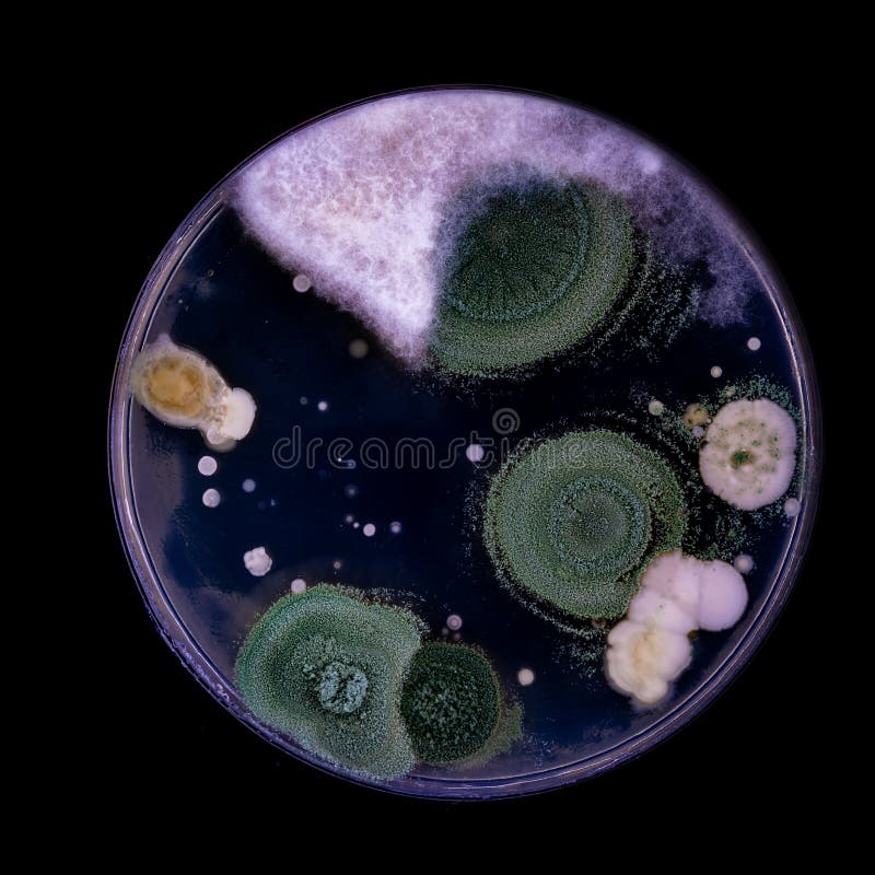 Samples of Petri Dishes with a Culture of Microorganisms and Fungi in ...