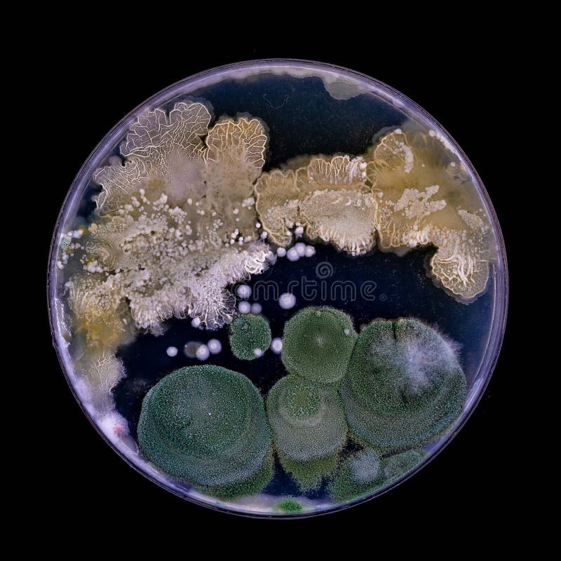 Samples of Petri Dishes with a Culture of Microorganisms and Fungi in ...