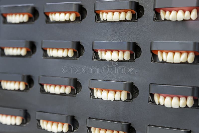 Samples with Porcelain Teeth and Dental Prosthesis and Dental Bridges ...