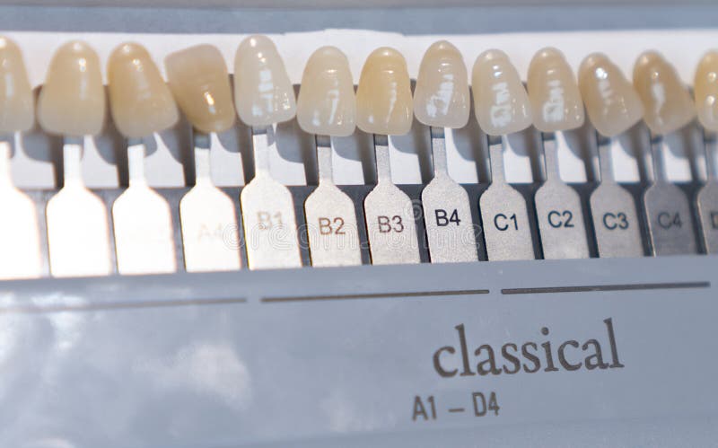 Samples of Teeth of Various Shapes and Colors. Stock Image - Image of ...