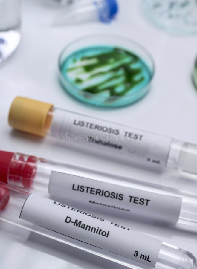 Samples You Analyze of Stuffed Meat Contaminated by Bacterium of ...