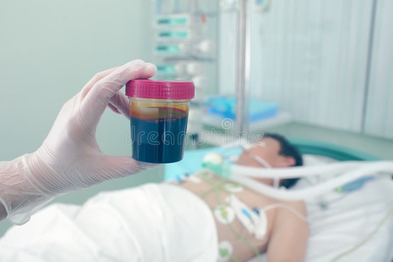 Sampling Patient in Critical Condition Stock Image - Image of emergency ...