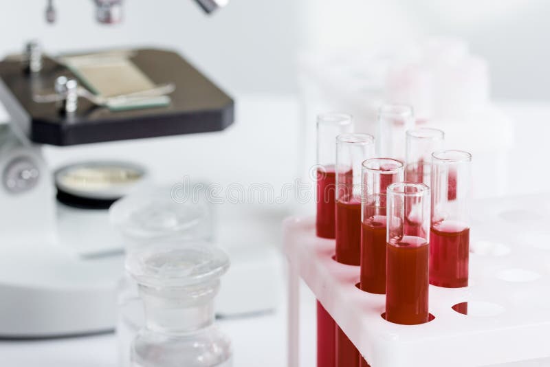 Sang Dans Des Tubes De Verre Sur Le Fond Du Microscope Photo stock ...