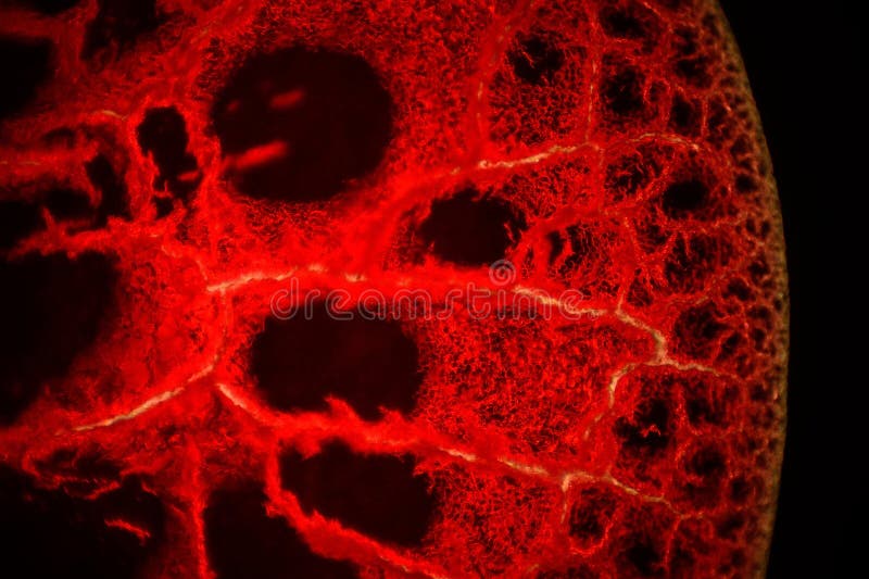 Mancha De La Sangre Humana Debajo Del Microscopio Foto de archivo ...