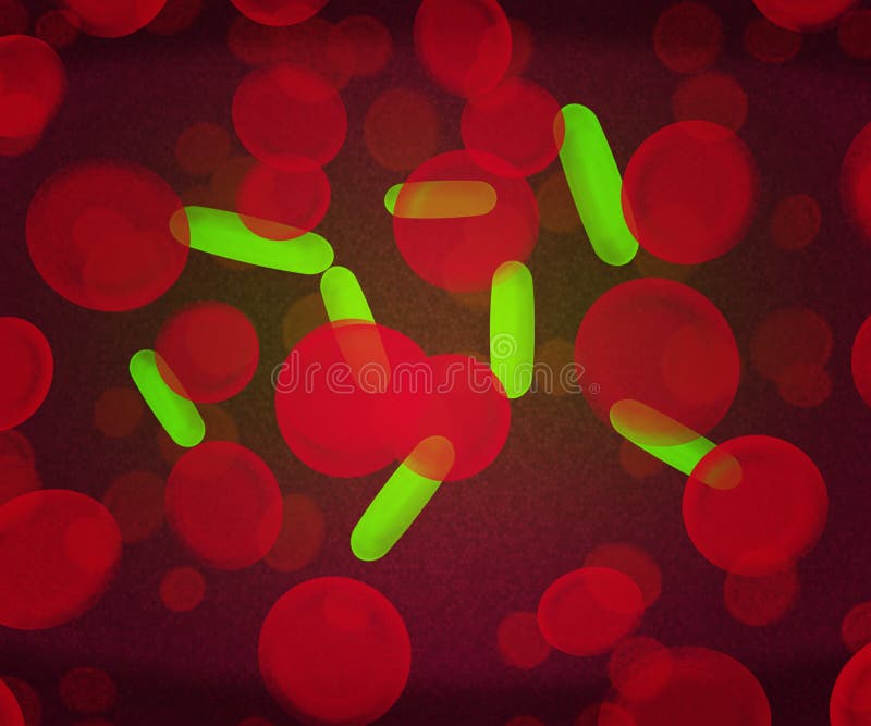 Sangre infectada imagen de archivo. Imagen de aguja, cuidado - 25017395