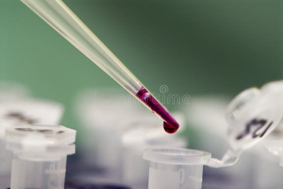 Sangre infectada foto de archivo. Imagen de medicina, gota - 2684254